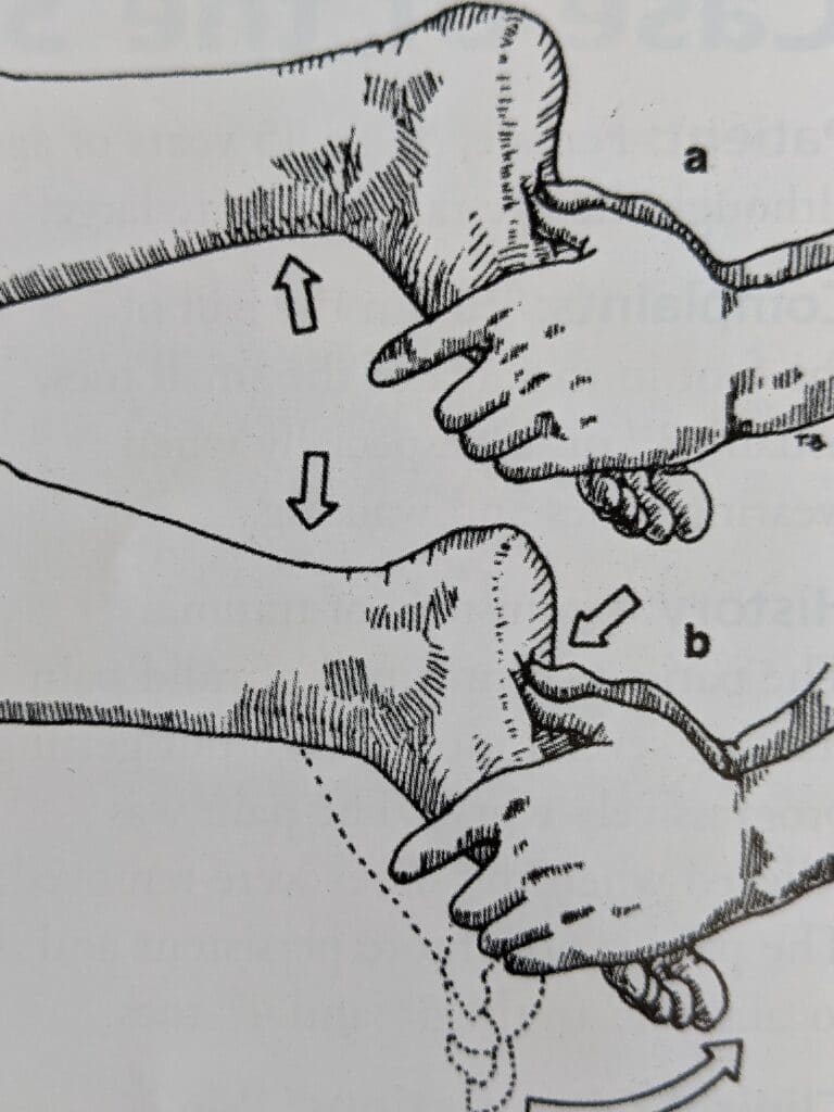 Cuboid Syndrome - Paragon Orthotic Laboratory